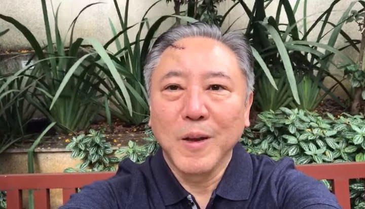 IOSHI SOFRE QUEDA EM CASA, BATE CABEÇA E LEVA VÁRIOS PONTOS; "estou bem ...