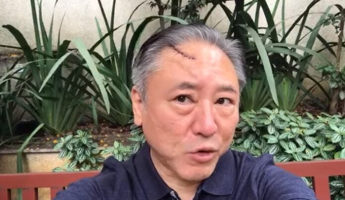 IOSHI SOFRE QUEDA EM CASA, BATE CABEÇA E LEVA VÁRIOS PONTOS; "estou bem ...